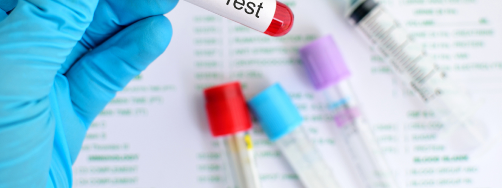 Micronutrient Test: 6 Reasons You Should Get It - CORR